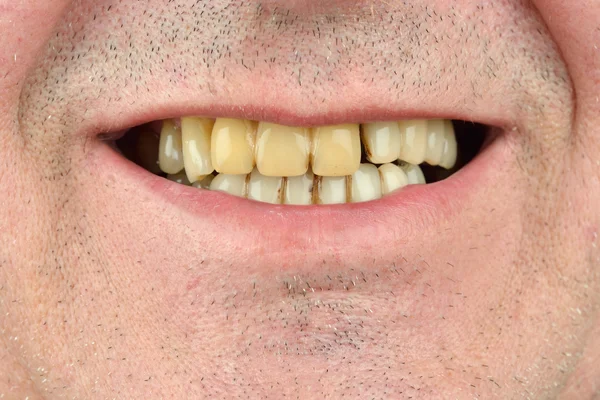 Detailed image of man showing his teeth. Dental health care. Hyg ...