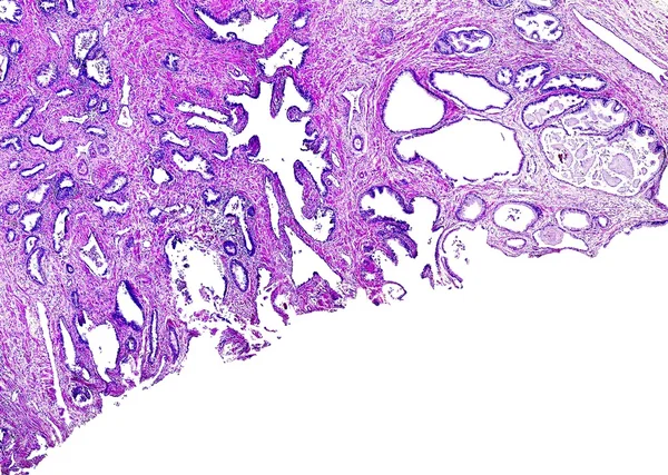 Mold — Stock Photo © bond80 #1026080