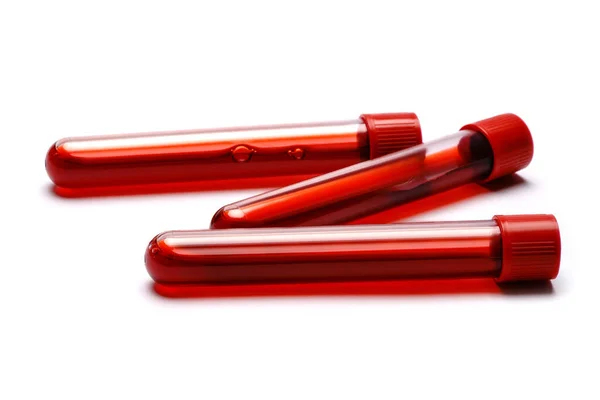 Blood vials Stock Photos, Royalty Free Blood vials Images | Depositphotos