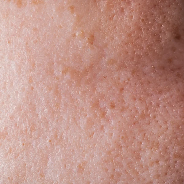 Human face skin texture Images - Search Images on Everypixel