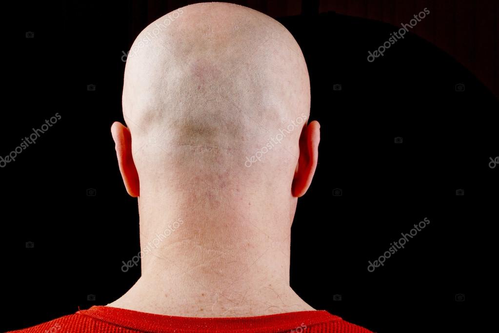 Bald middle aged man | Bald head middle-aged man — Stock Photo ...
