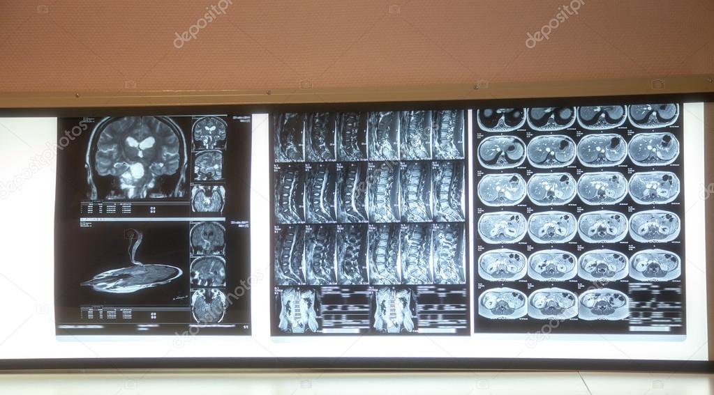 X-ray scans — Stock Photo © jovannig #55856259 X-ray scans — Stock Photo © jovannig #55856259