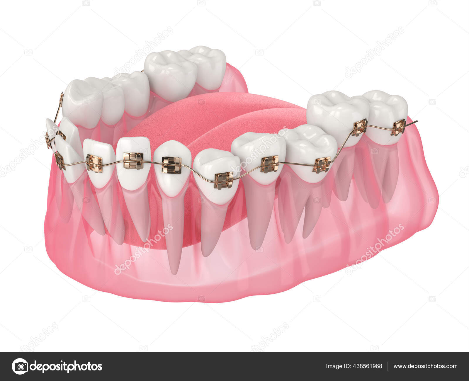 Teeth Braces Background
