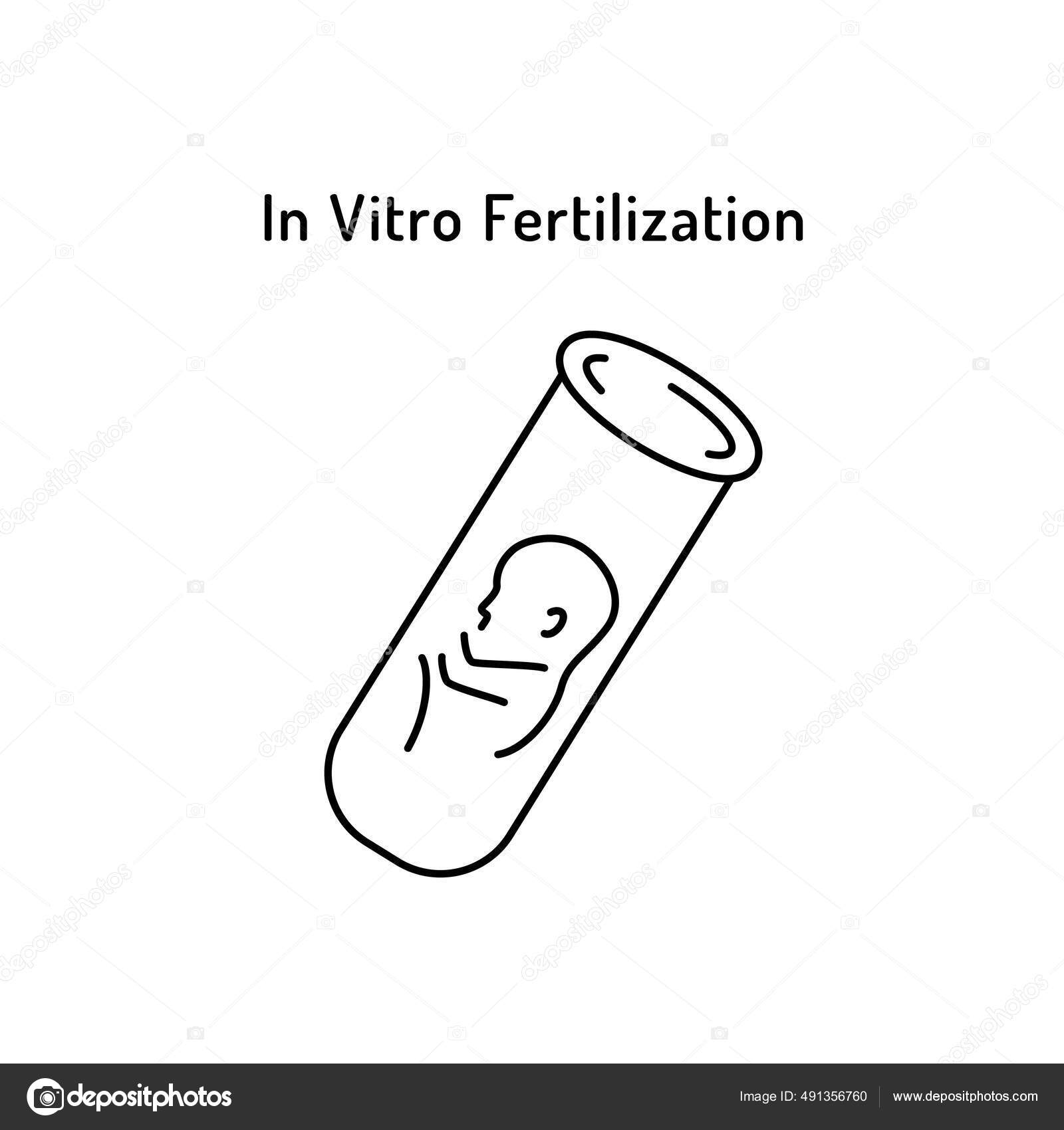 In Vitro Fertilization Vector Logo. Fetus in Test Tube Symbol Stock ...