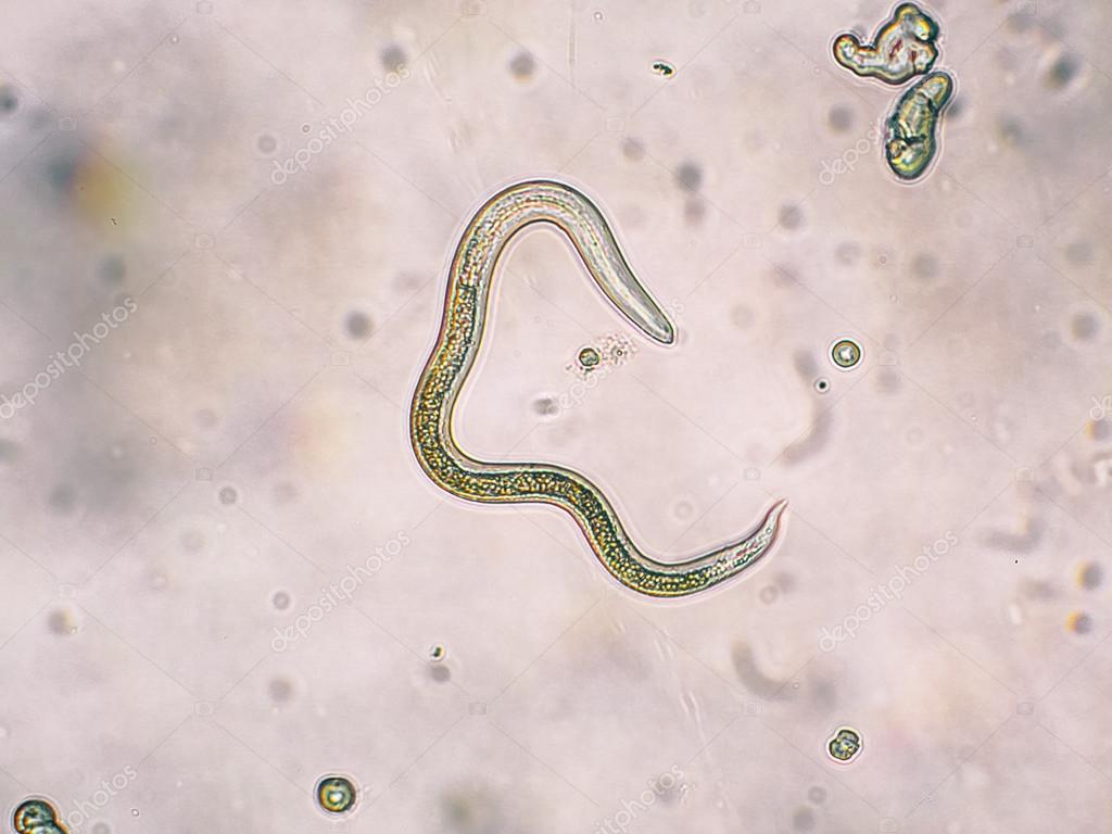 Roundworm Larvae