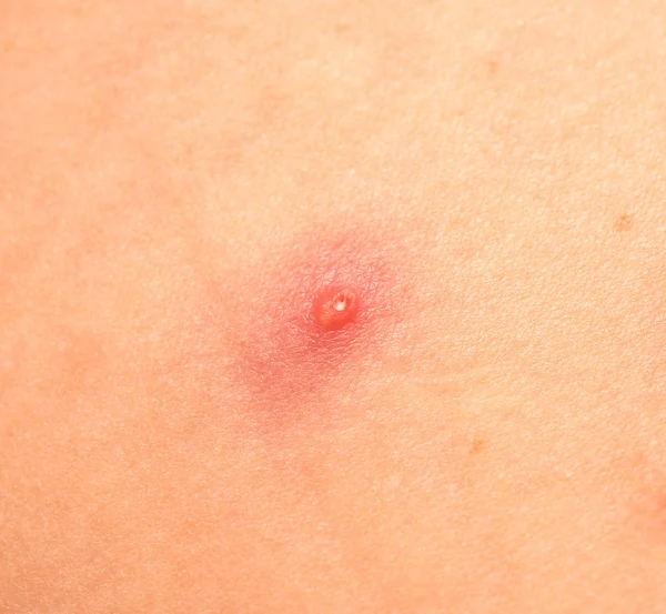 Photos. — Stock Photo © schankz #27584075