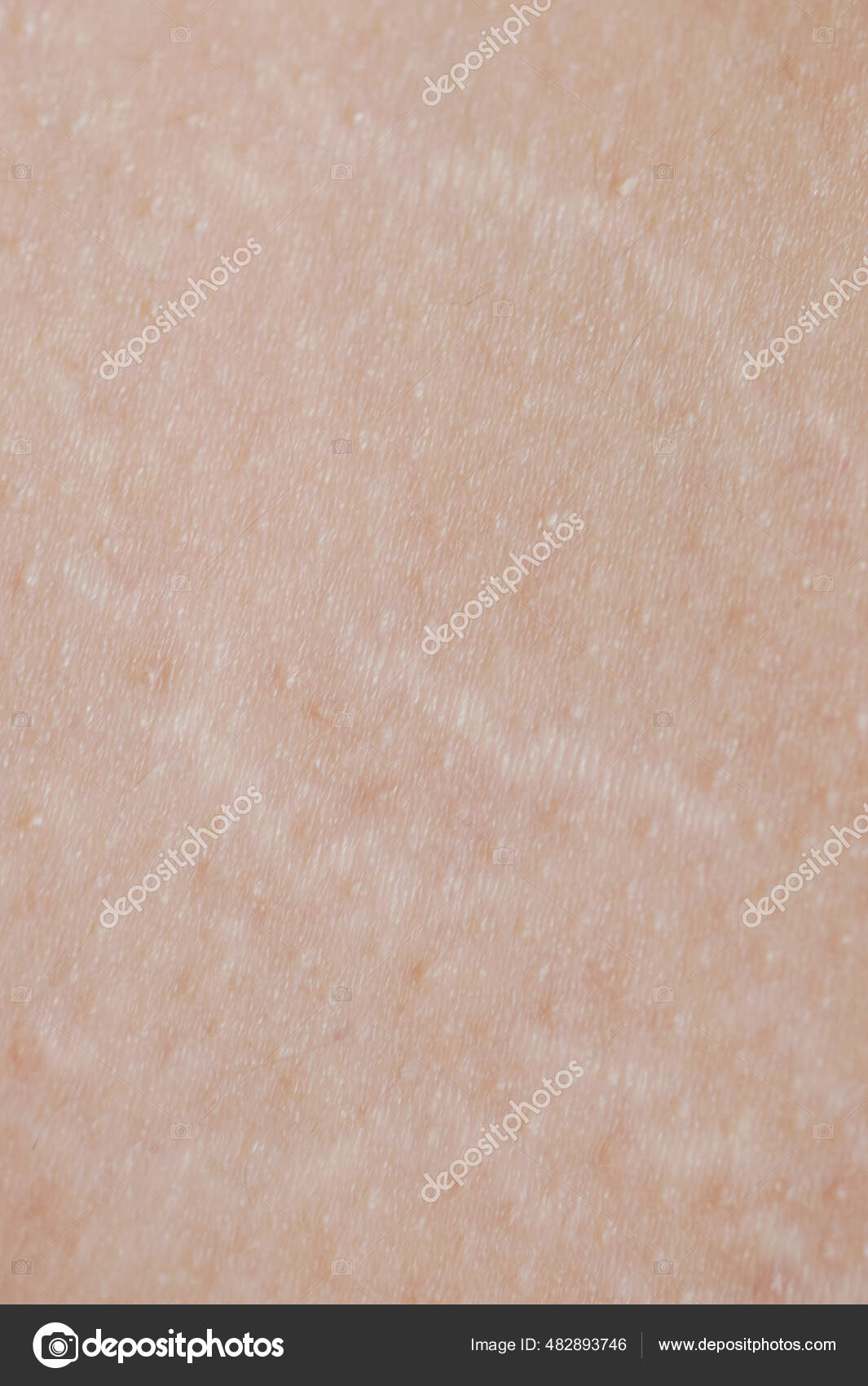 Stretch Human Skin Background Macro Close View — Stock Photo © dimarik ...