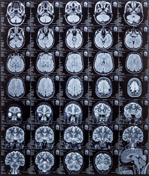 Magnetic resonance imaging - Stock Image - Everypixel