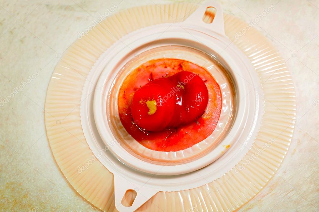 Colostomy — Stock Photo © pajche #71379241