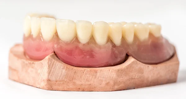 Prótesis dentaria inmediata Superior 2024