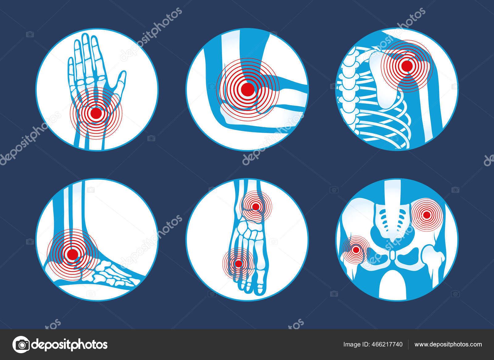 Six rheumatology icons Stock Vector Image by ©yupiramos #466217740