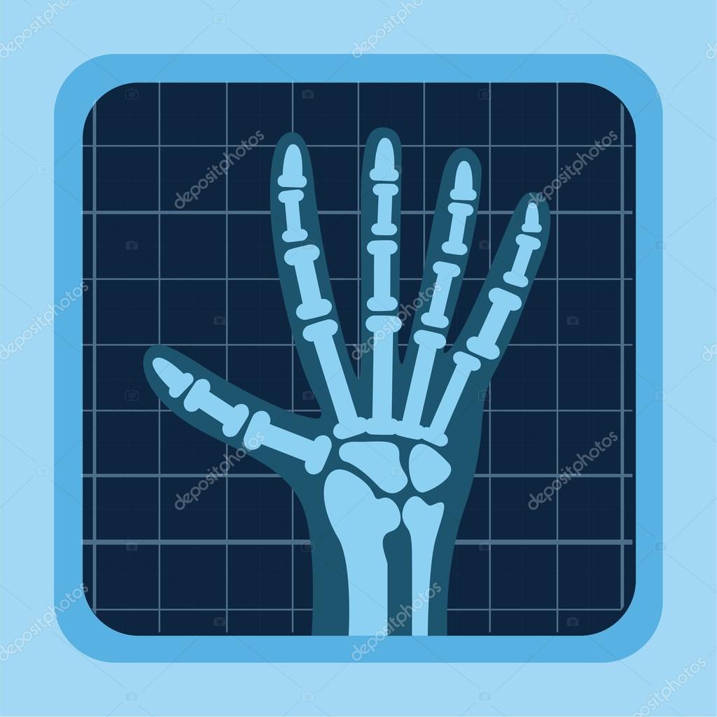 X rays design Stock Vector Image by ©yupiramos #56442987