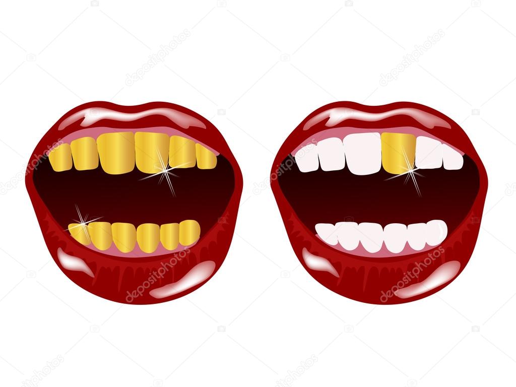 Cartoon Lips With Gold Teeth | Lipstutorial.org
