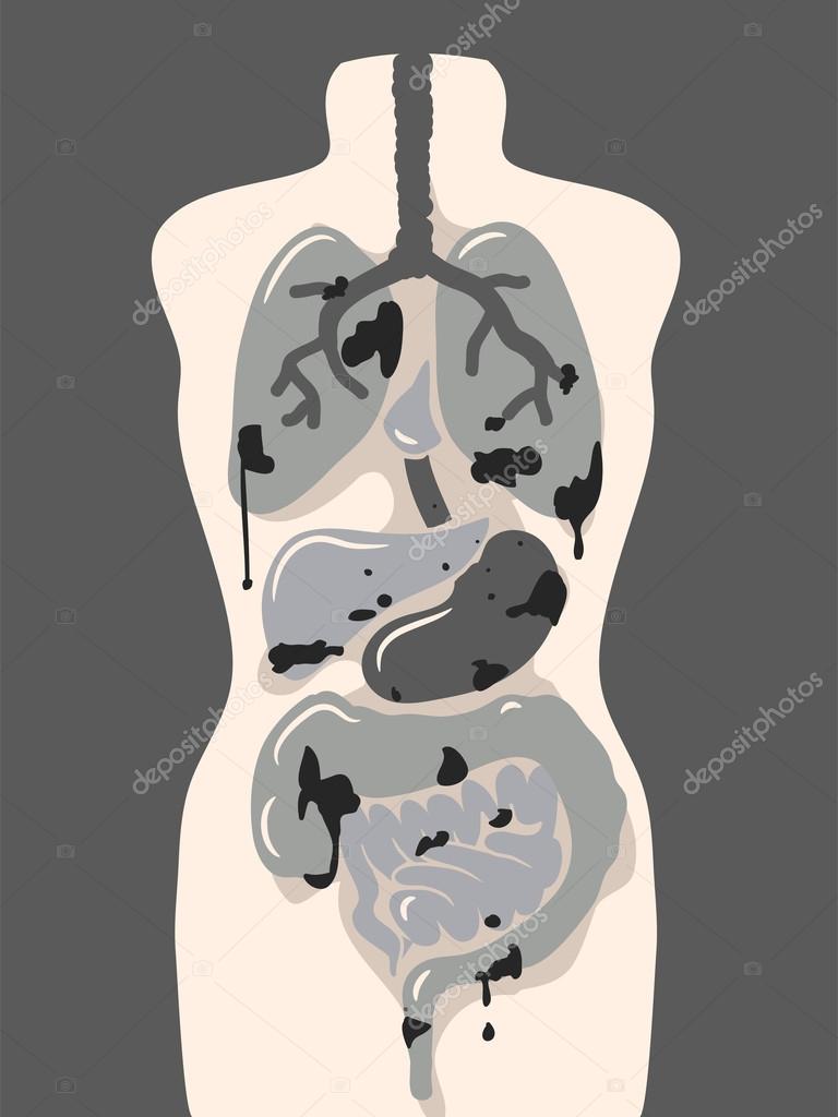 Damaged Internal Organs Stock Photo by ©lenmdp 58947407