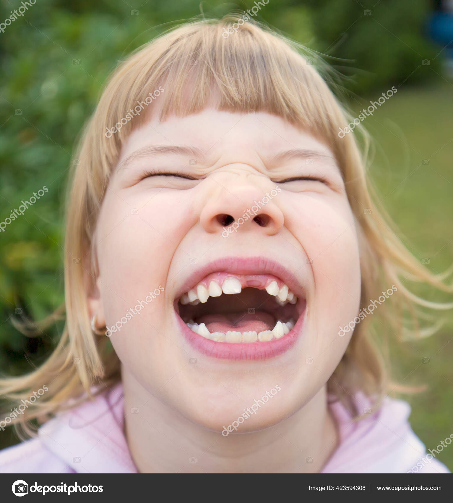 Cute Young Child Make Grimace Missing Teeth — Stock Photo © joruba75 ...