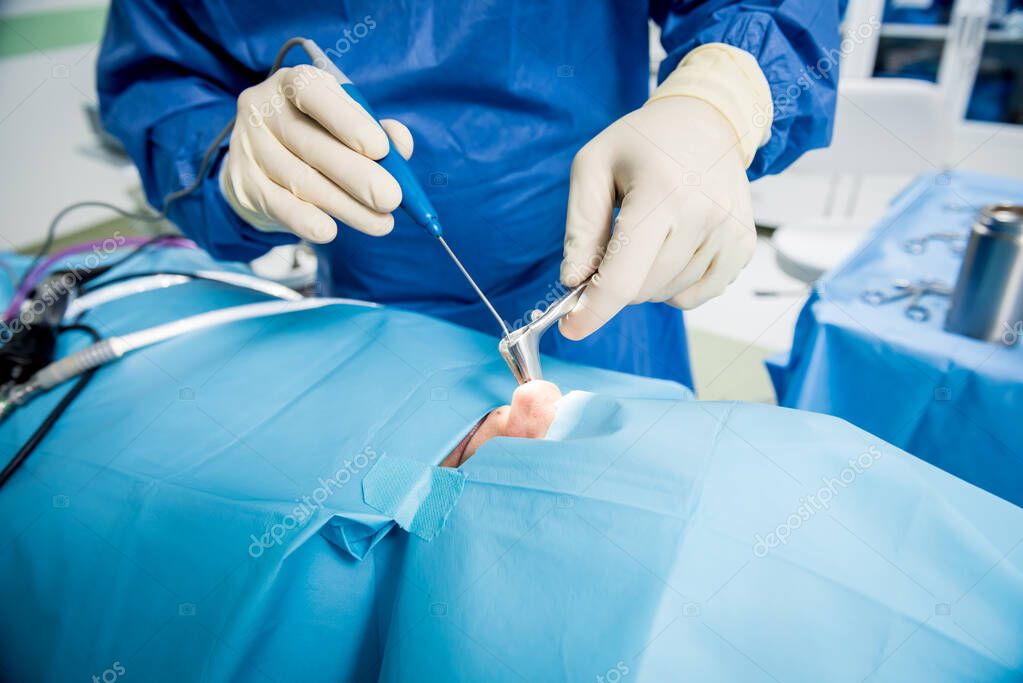 Rinocerurgia funcional para restaurar la respiración nasal con tecnología de coblación. 2022