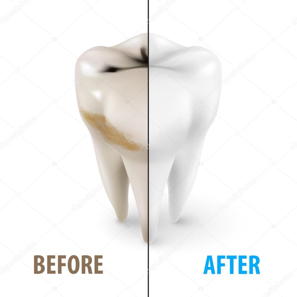 Teeth Whitening Icon, Dentist Symbol in Isometric Style on White Stock ...