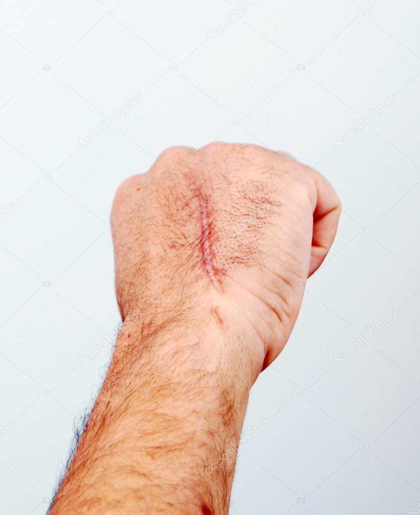 Wounded male hand by knife Stock Photo by ©nehruresen 106512062