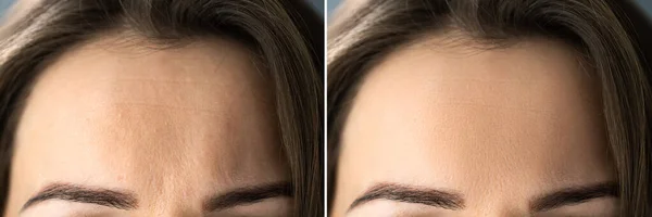 Woman forehead Stock Photos, Royalty Free Woman forehead Images ...