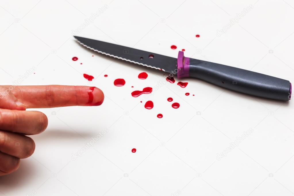 A cut of finger while cooking. — Stock Photo © Koldunov #85189936