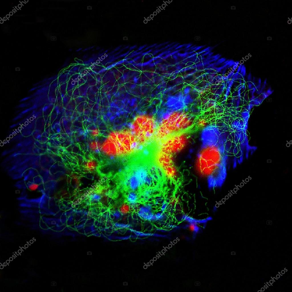 Fotos de Neuroblastoma humano - Imagen de © vshivkova #101849570