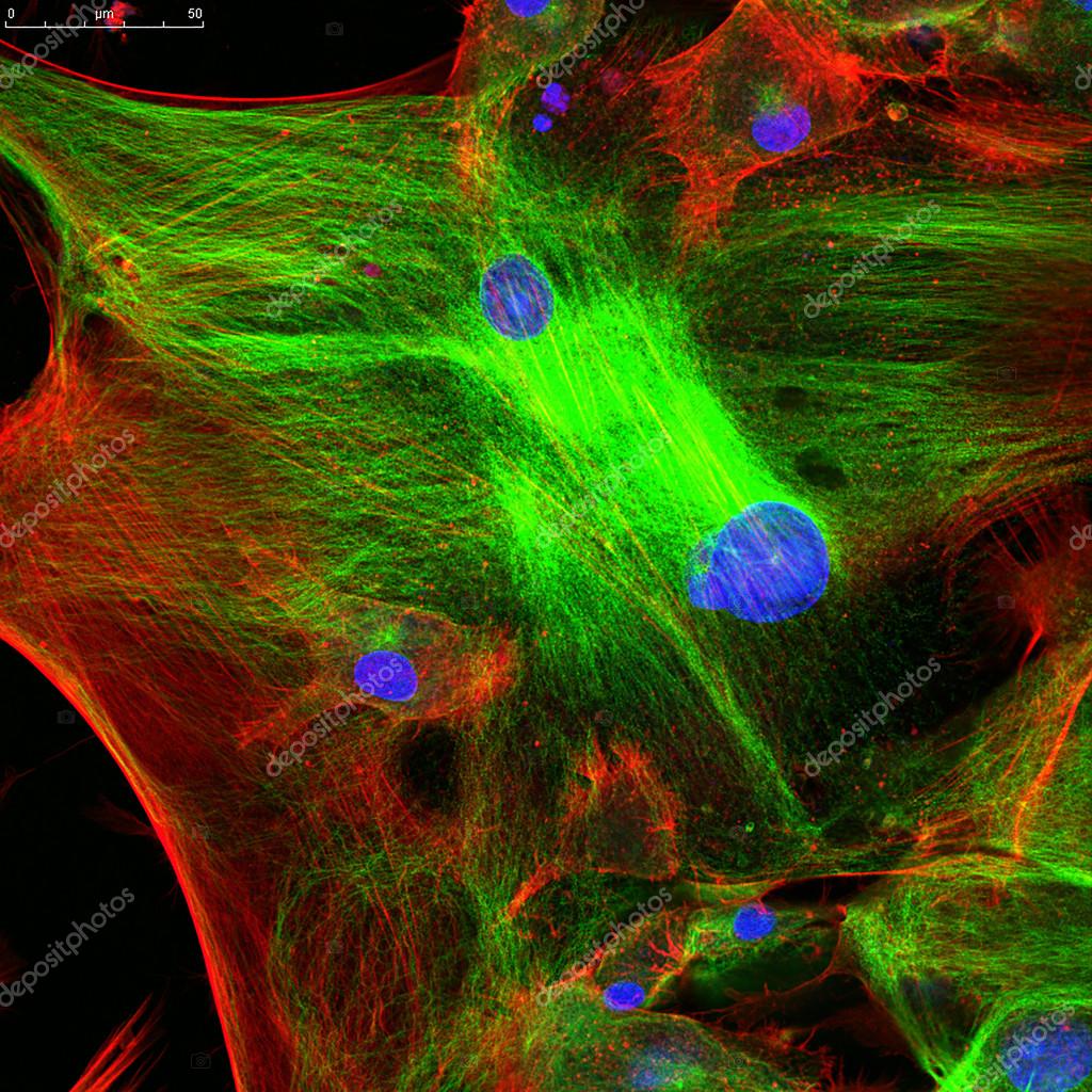 Confocal microscopy of fibroblast cells Stock Photo by ©vshivkova 119227420