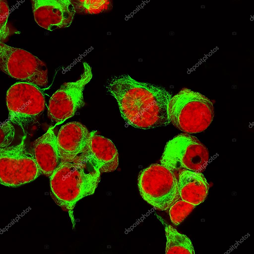 Vista microscópica de fluorescencia real de las células del ...