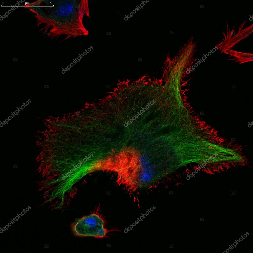 Confocal microscopy of fibroblast cells — Stock Photo © vshivkova ...