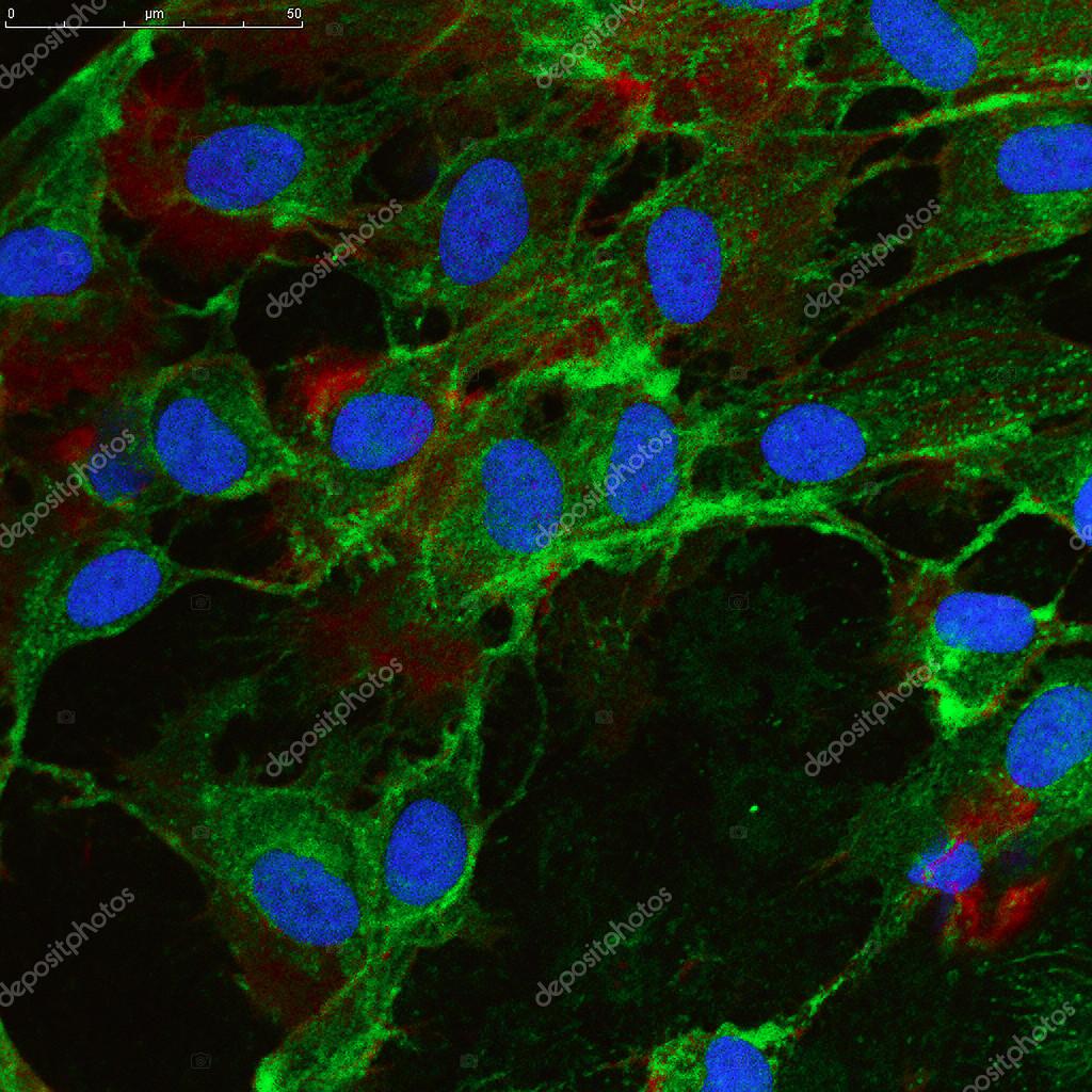 Mesenchymal Stem Cells Confocal