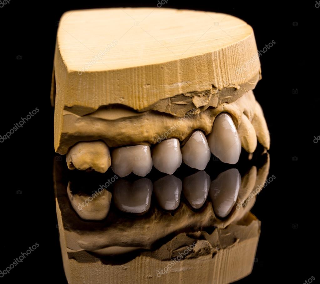 Ceramic dentures, reflection — Stock Photo © grafvision #116291556