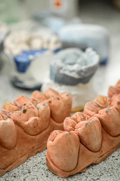 Intraoral defects Stock Photos, Royalty Free Intraoral defects Images ...