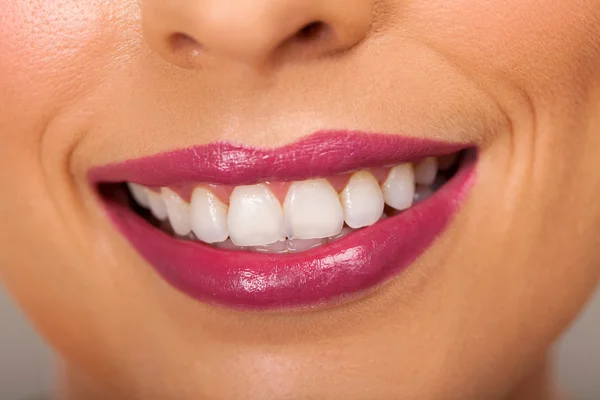 Healthy woman teeth - Stock Image - Everypixel