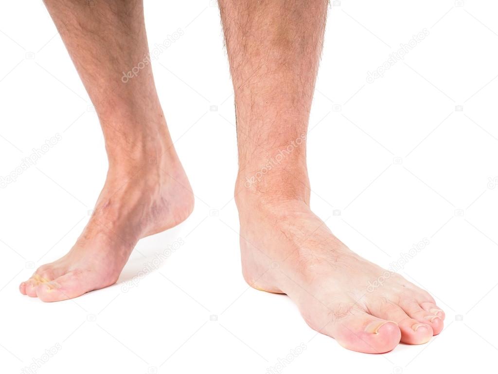 Male person with hairy legs, walking towards — Stock Photo © AB ...