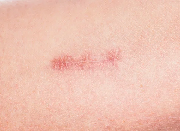 Cerrar pespontas Stock Photos, Royalty Free Cerrar pespontas Images ...