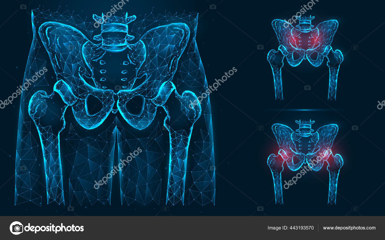 Bassin Hanche Anatomie Humaine Lésions Pelviennes Hanche Rayon L ...