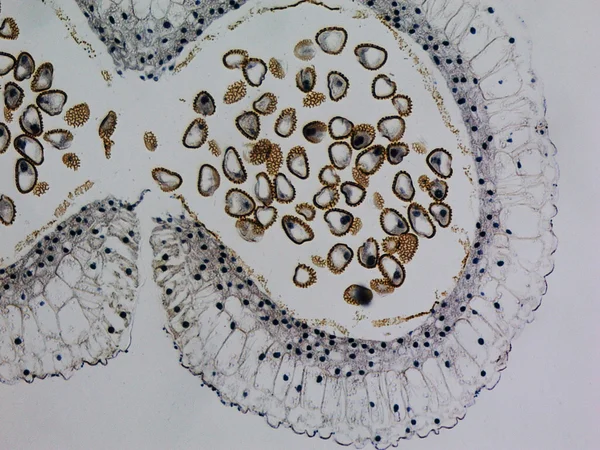 Lily anther micrograph ⬇ Stock Photo, Image by © claudiodivizia #61357835 Lily anther micrograph ⬇ Stock Photo, Image by © claudiodivizia #61357835