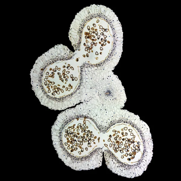 Lily anther micrograph ⬇ Stock Photo, Image by © claudiodivizia #61357835 Lily anther micrograph ⬇ Stock Photo, Image by © claudiodivizia #61357835