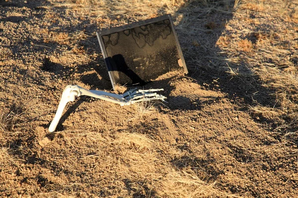 Crime Scene Decomposed Human Body Just Skeleton Remaining Half Buried ...