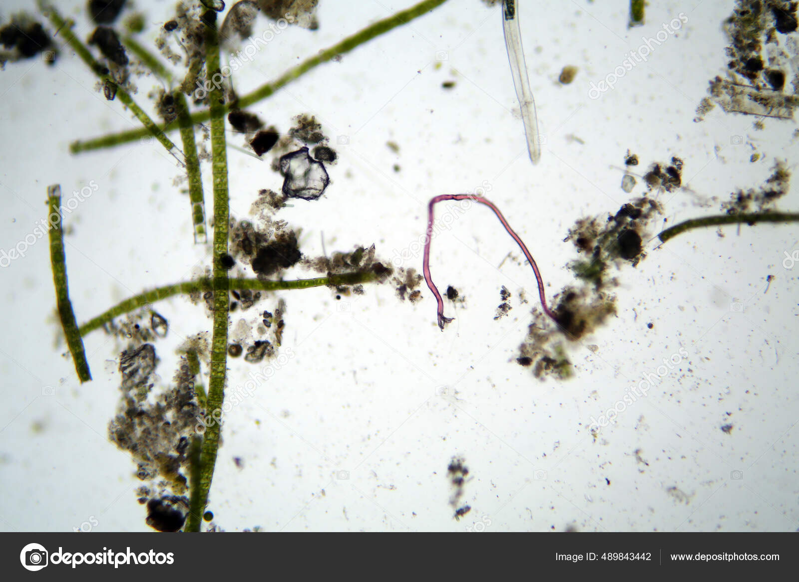 Vida Microscópica Microscopio Animal Una Sola Célula Organismo Viviente ...