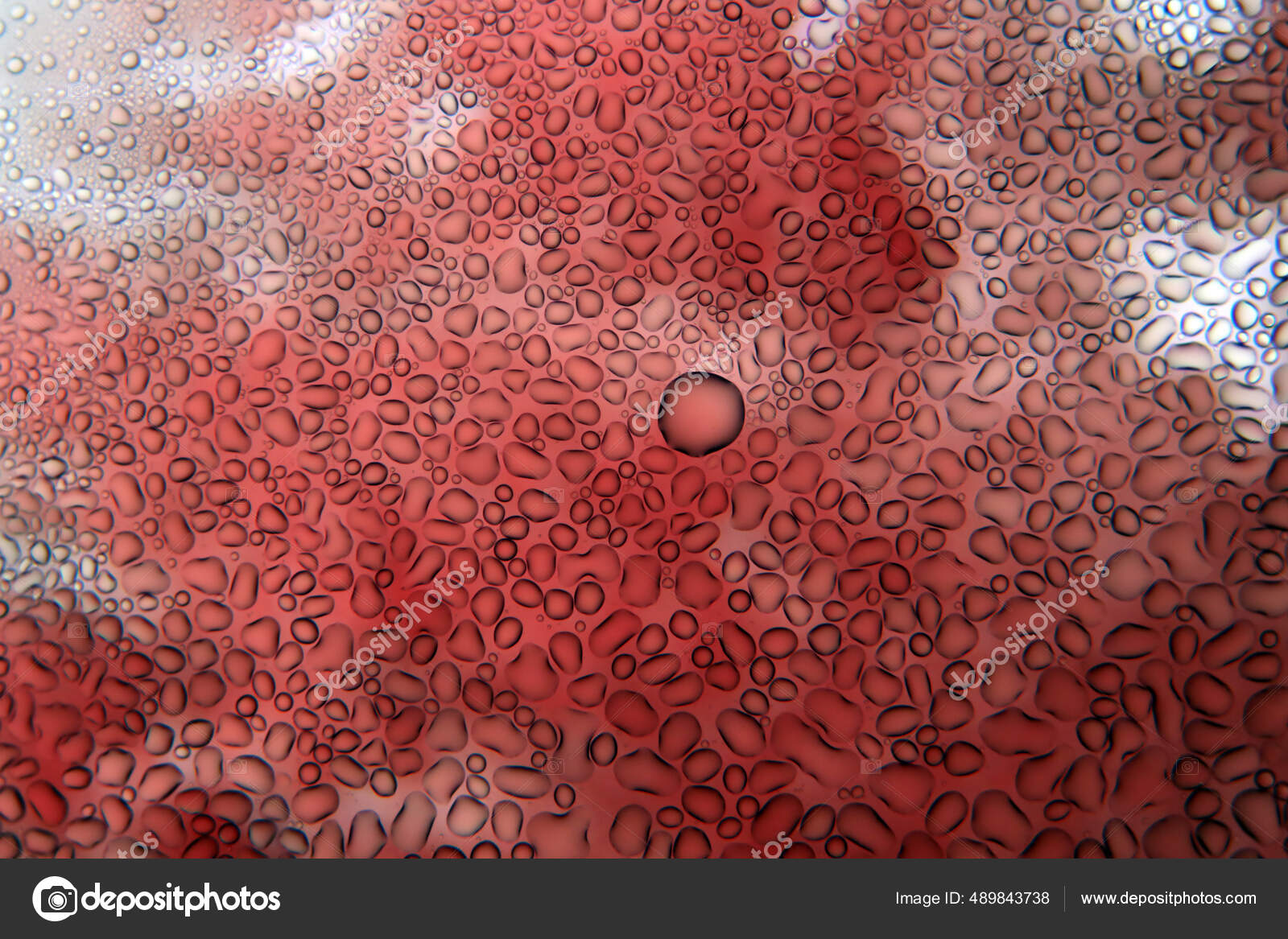 Darah Darah Bawah Mikroskop Sel Darah Merah Sel Darah Manusia — Foto ...