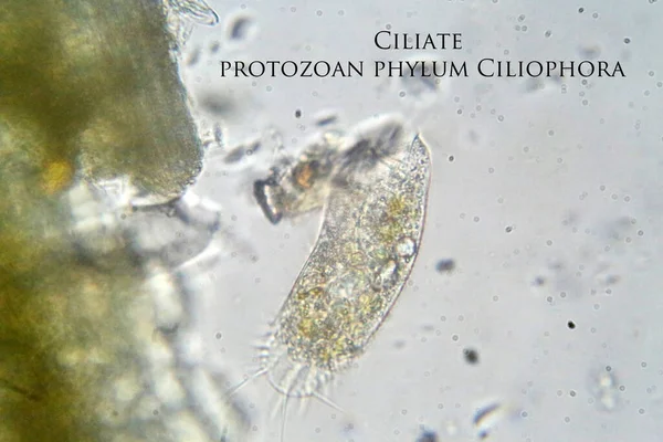 Ciliate protozoa Stock Photos, Royalty Free Ciliate protozoa Images ...