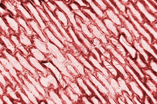 Cellen van de ui Stockfoto's, Rechtenvrije Cellen van de ui ...