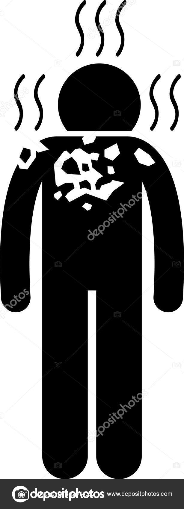 Melanoma Skin Cancer Symptoms Causes Risk Factors Diagnosis Stick ...