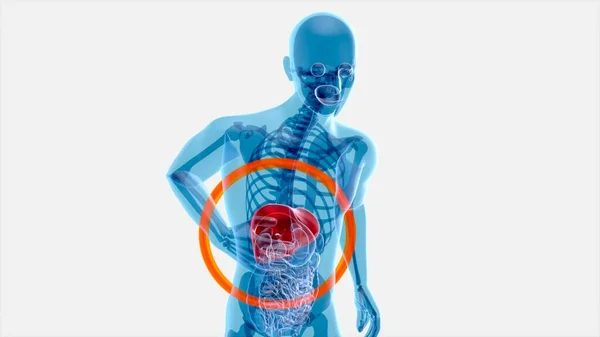 Scoliosis Illustration Human Body Curved Spine Uneven Shoulders Hips ...