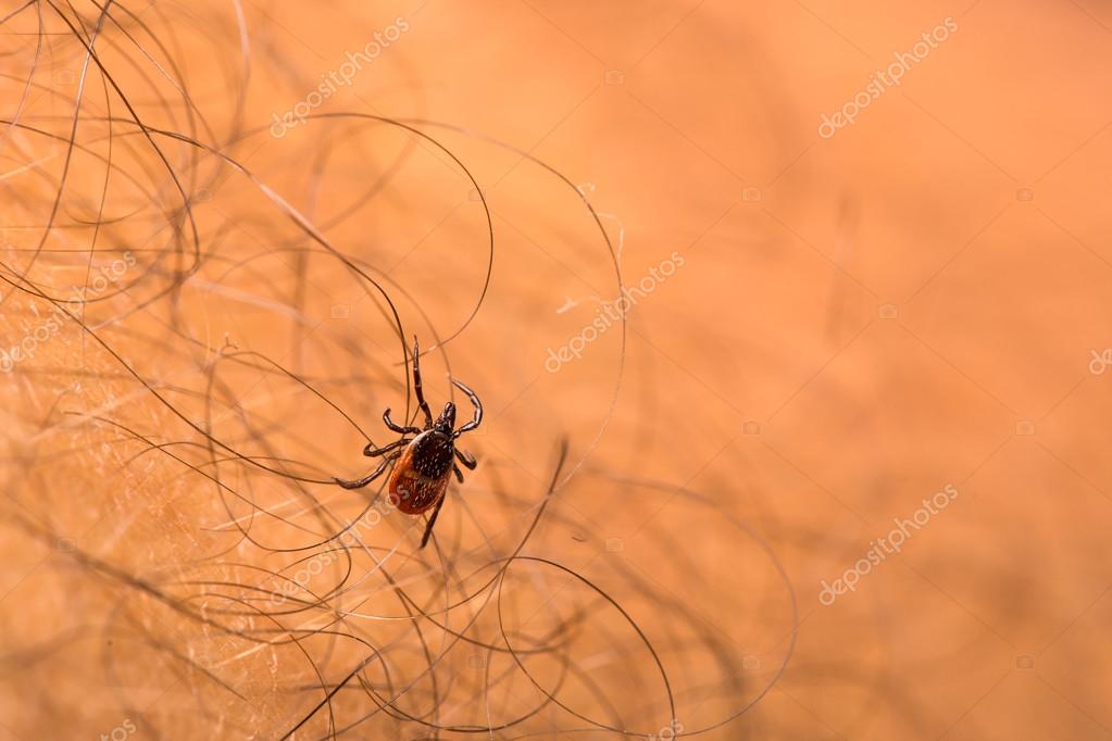 Tick close up view — Stock Photo © lightpoet #76324277