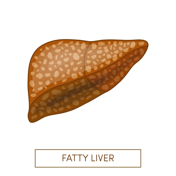 Simple fatty liver Vector Art Stock Images | Depositphotos