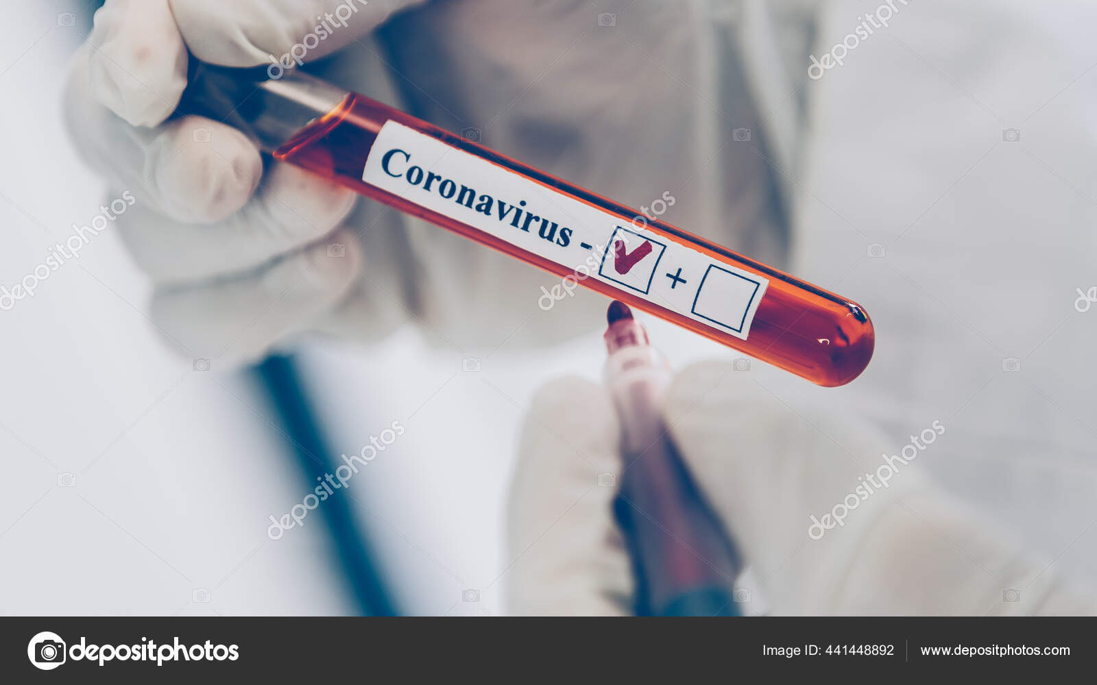 Close up. lab employee marking a verified test. — Stock Photo ...