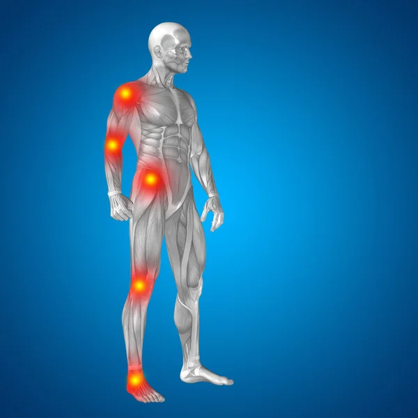 Man with with bones pain. Stock Photo by ©design36 103626378