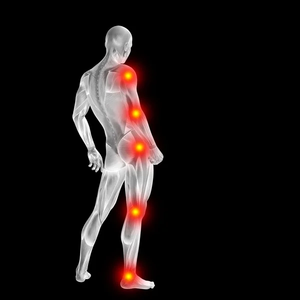 Body pain points Stock Photos, Royalty Free Body pain points Images ...