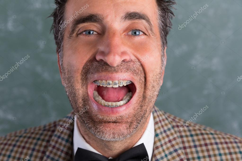 Nerd silly retro man with braces funny expression Stock Photo by ...